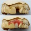 Nesbit Flexible Partial Denture Online | Vida Smile Care
