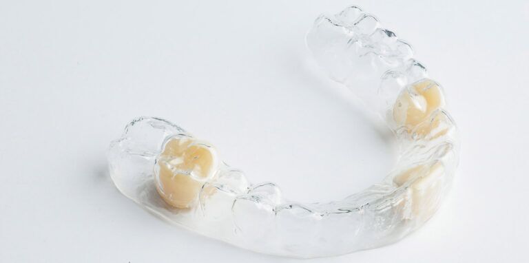 Essix Partial Denture Retainer: Pros, Cons, and Cost